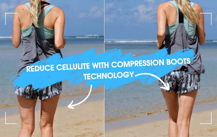 Reduce Cellulite With Compression Boots Technology – recoveryboots